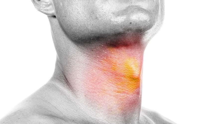 Head & Neck cancer | Ογκολόγος - Ακτινοθεραπευτής